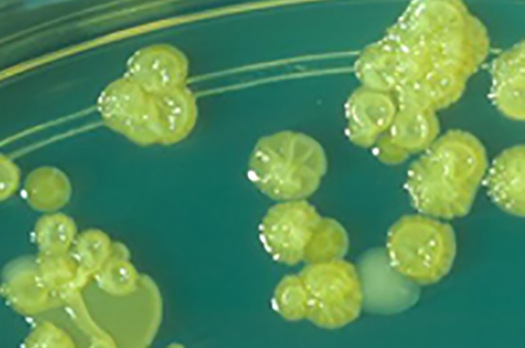 Controlling Cronobacter A Pathogen Of Concern In Dry Environments And